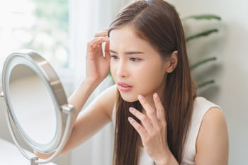 How to Get Rid of Stress Rashes: A Comprehensive Guide